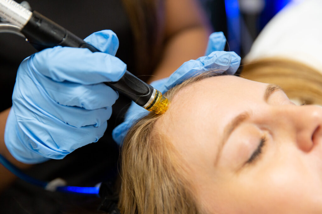 Scalp Treatment in San Antonio | Marcos Medical