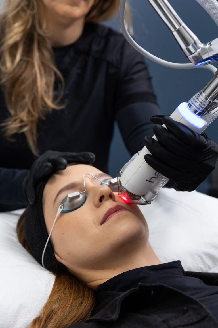 Laser Resurfacing Device in San Antonio | Halo | Marcos Medical
